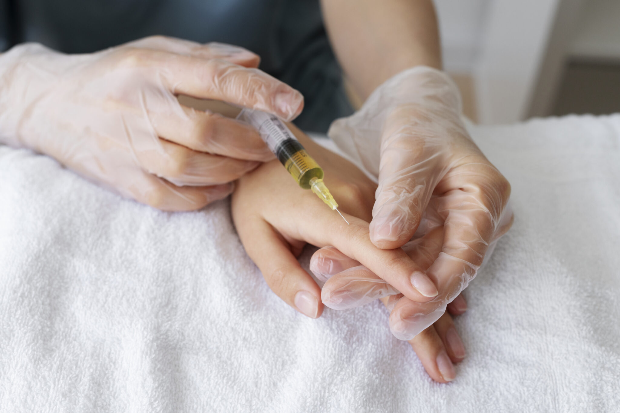 Hiperhidrosis palmar, síntomas y tratamiento - Prospera Biotech